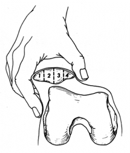Measuring the Position and Mobility of the Patella