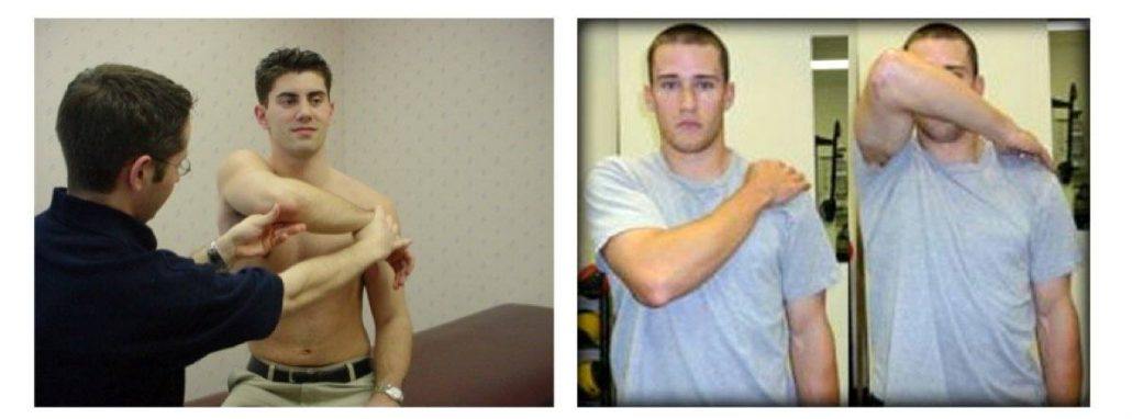 Shoulder Impingement - 3 Keys to Assessment and Treatment