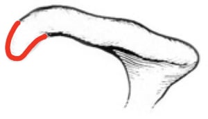 Subacromial Pain – Keys to the Evaluation and Treatment - Mike Reinold