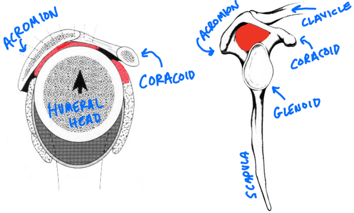 Shoulder Impingement 3 Keys To The Evaluation And Treatment Mike